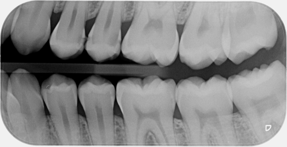 Radiologia odontoiatrica - Studio Odontoiatrico Amosso - Biella